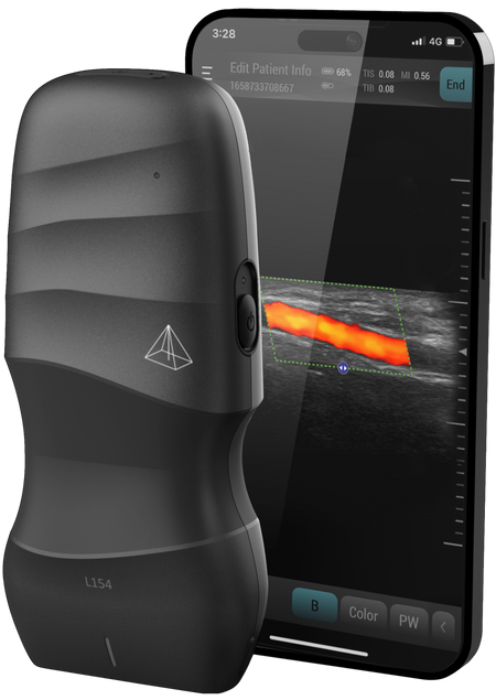 Neo Medical Inc: Wireless handheld ultrasound
