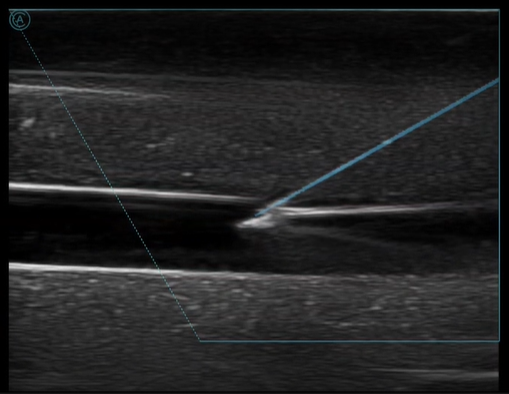 Neo Medical Inc: Wireless handheld ultrasound – Neo Medical USA Inc