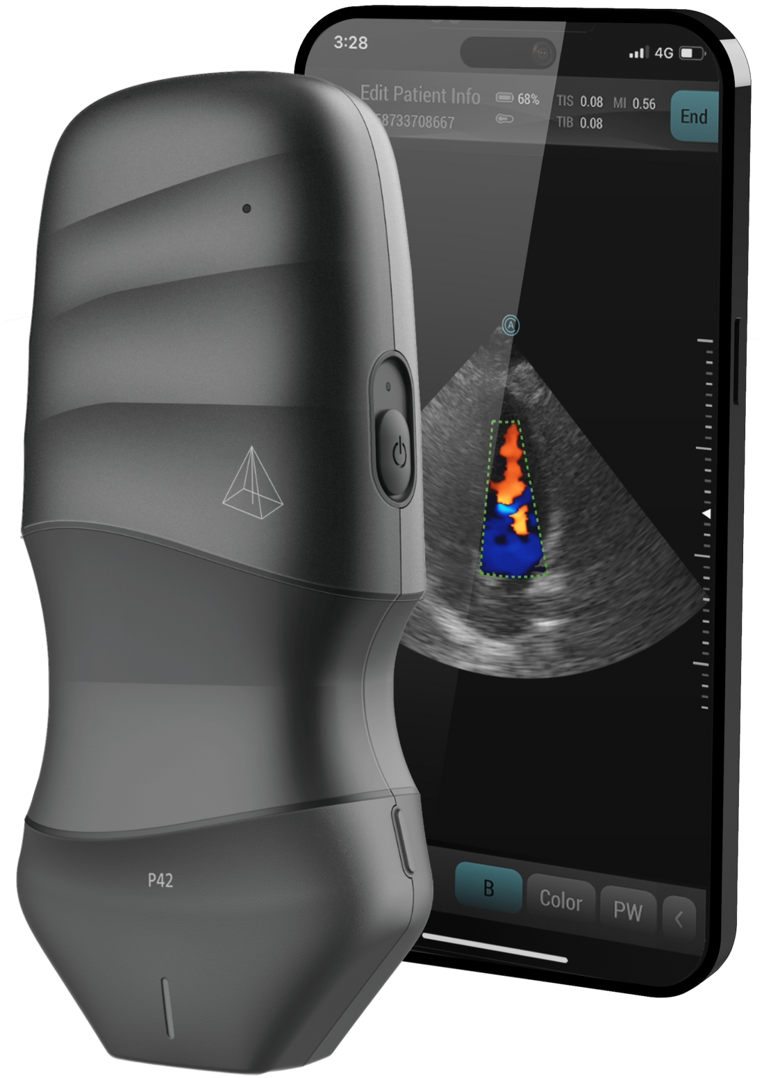 Neo Medical Inc: Wireless handheld ultrasound – Neo Medical USA Inc