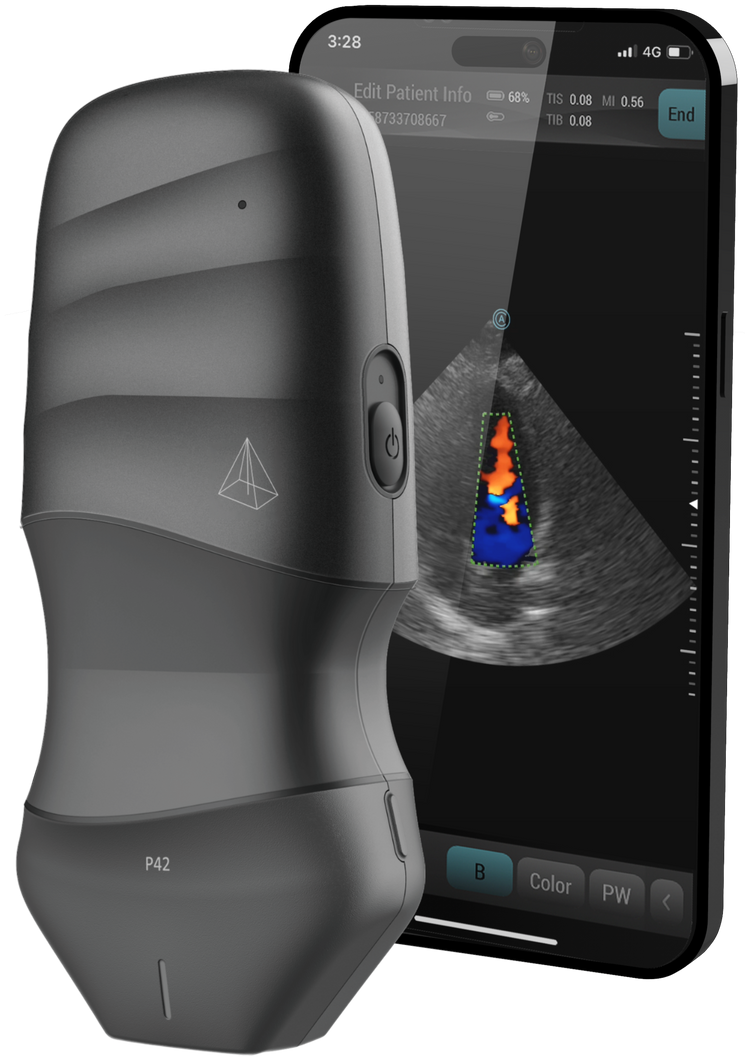 Neo Medical Inc: Wireless handheld ultrasound – Neo Medical USA Inc